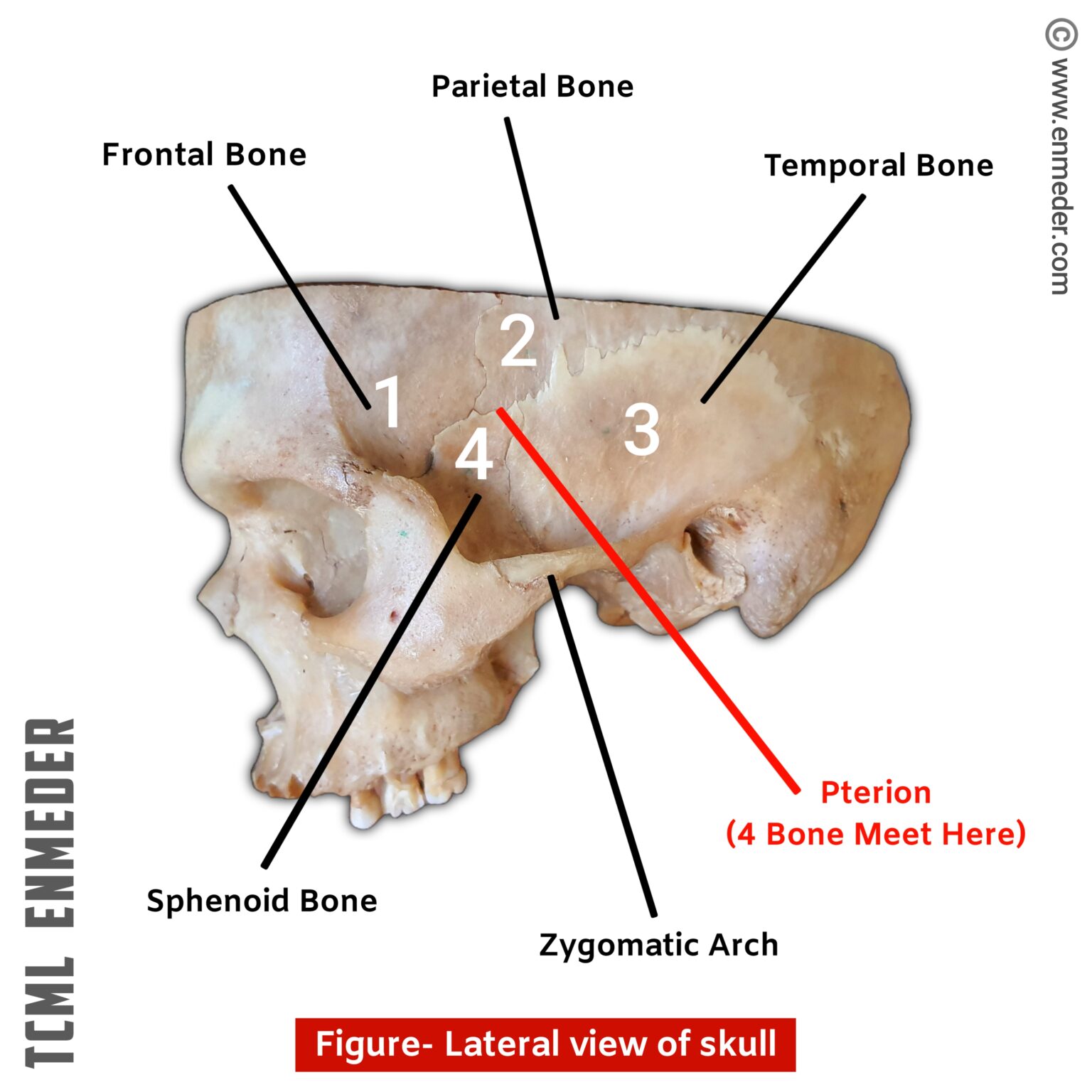 Pterion - TCML - The Charsi of Medical Literature