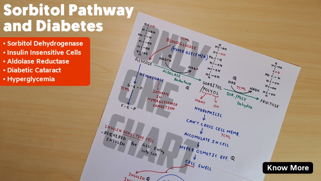 Sorbitol pathway and diabetic cataract - TCML - The Charsi of Medical Literature