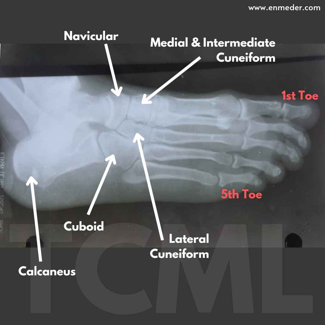 Tarsal Bone TCML The Charsi Of Medical Literature