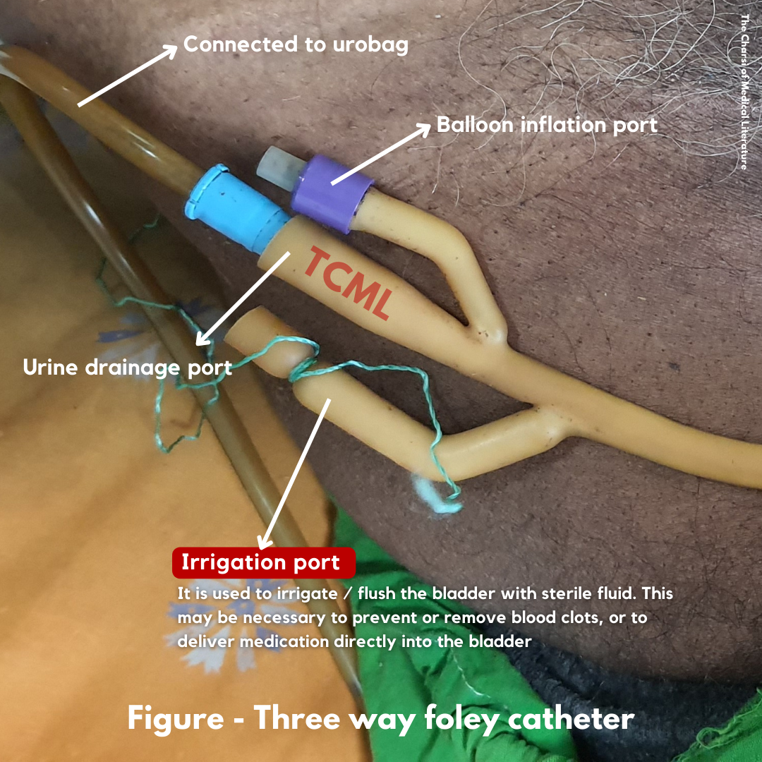 3 Way And 2 Way Foley Catheter TCML Flux 3 Way And 2 Way Foley Catheter TCML Flux