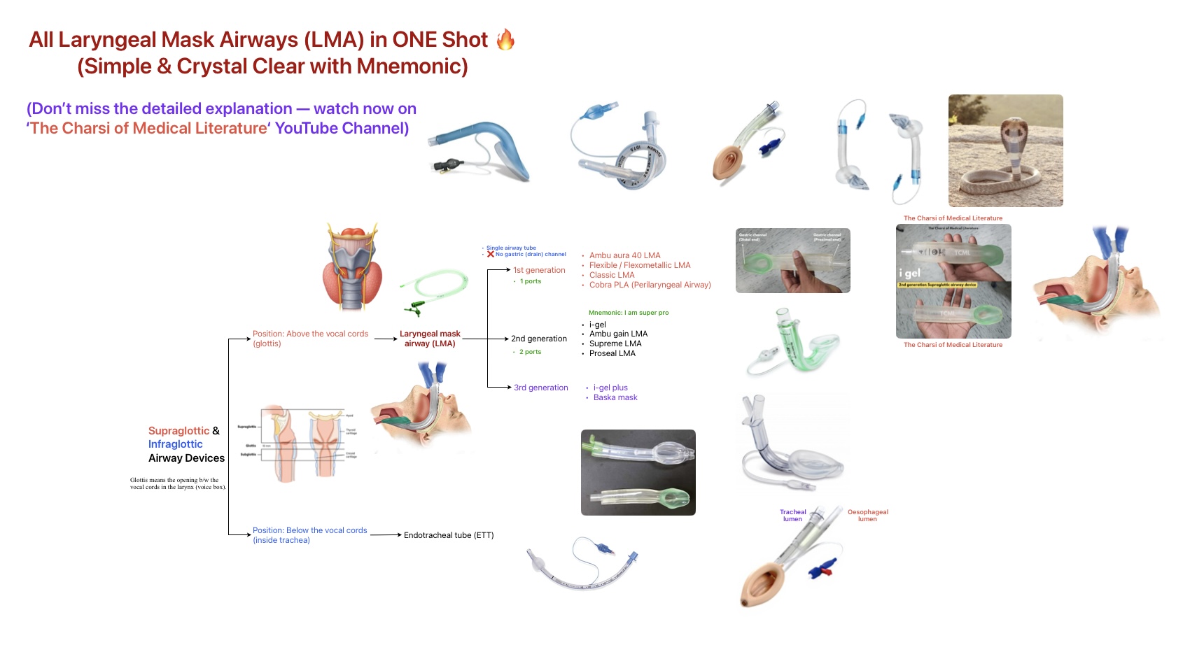 Laryngeal mask airways - TCML - The Charsi of Medical Literature
